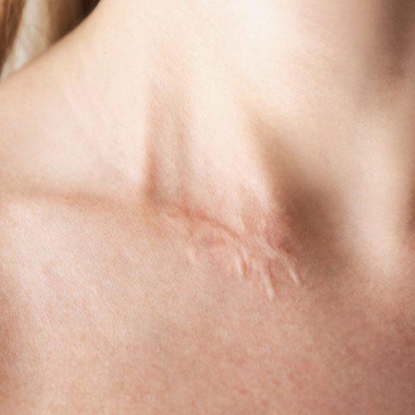 Abnormal Scars | Matthew Potter